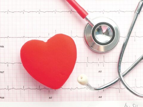 ECG - Électrocardiogrammes - Prélèvement MG